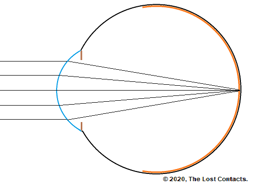 The Optics of Vision - Lesson 6: Emmetropia & Myopia - The Lost Contacts