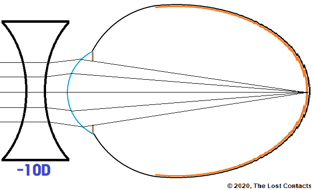 The Optics of Vision - Lesson 6: Emmetropia & Myopia - The Lost Contacts