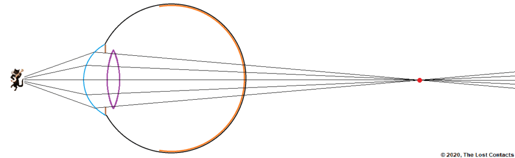 The Optics of Vision - Part 9: The Crystalline Lens - The Lost Contacts