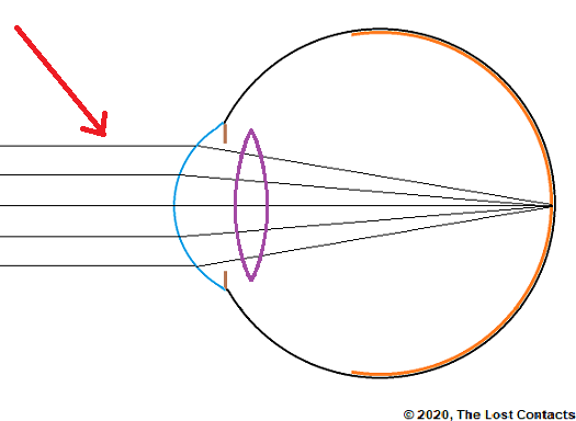 The Optics of Vision - Part 9: The Crystalline Lens - The Lost Contacts